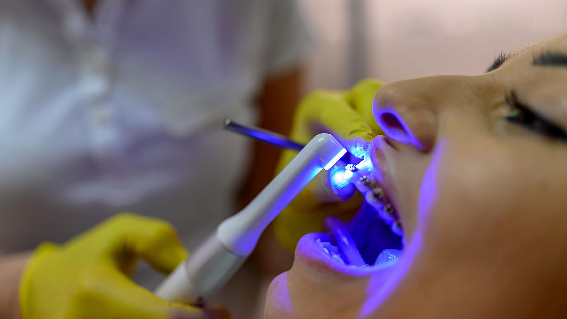 Dental Lasers | The Dental And Denture Care Center | Spring Hill, FL