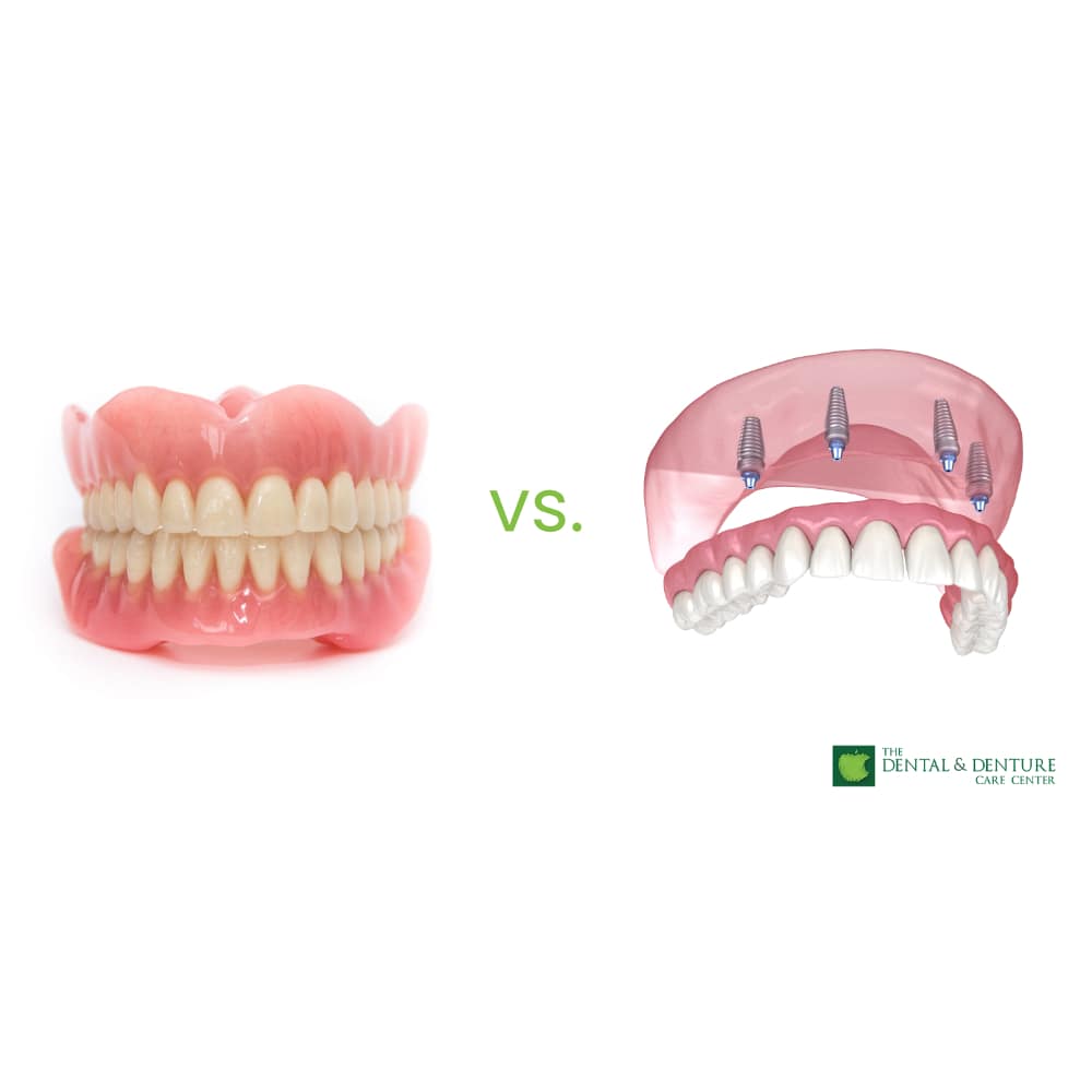 Snap-In Dentures vs. Regular Dentures - The Dental & Denture Care Center